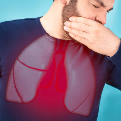 Mellhártya gyulladás - Tüdő Központ