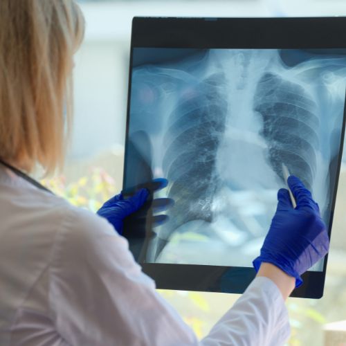 COPD - Tüdőközpont